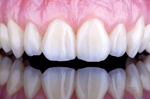 ZIRKONZAHN: PRETTAU® ZIRCONIA FOR MONOLITHIC DESIGN - The Dental Technician